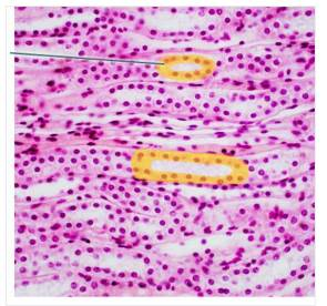 Identify the type of highlighted epithelial tissue - Learnexams