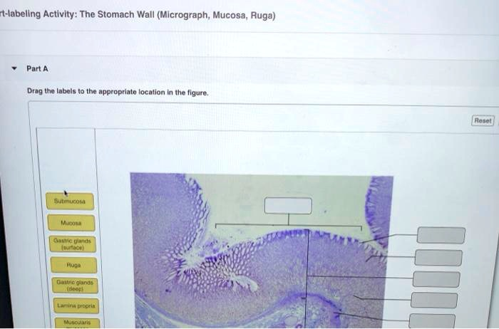The Stomach Wall Micrograph, Mucosa, Ruga - Learnexams